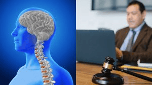 Understanding Concussions: Causes and Legal Options for Victims